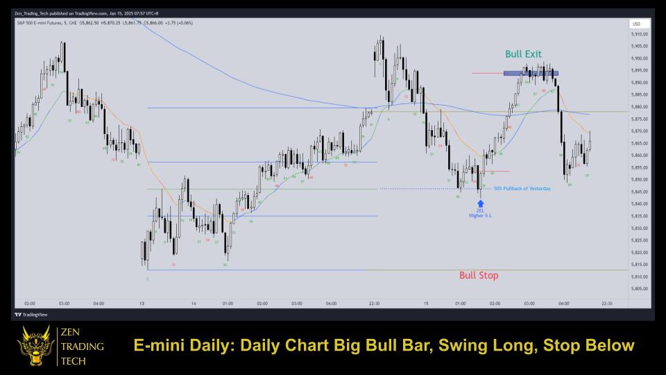 🔥 5 Powerful Daily Chart Swing Setups for Smarter Trading 📈 – Zen ...